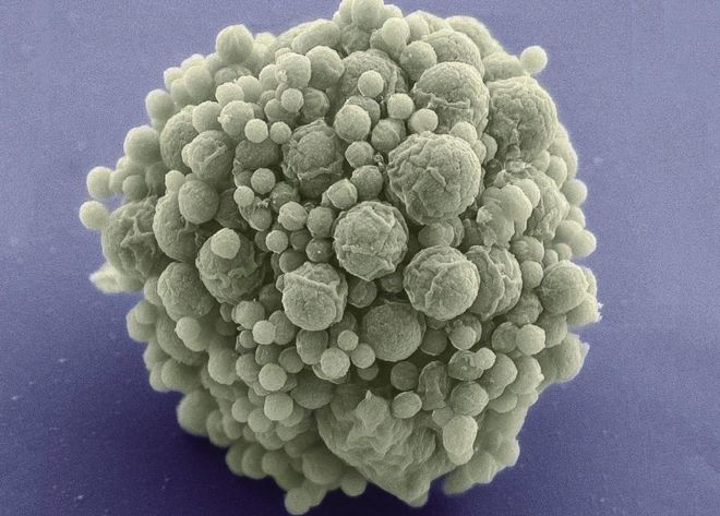 Engineering A Minimal Genome - NeuroLogica Blog