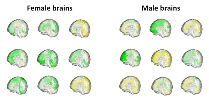 Male and Female Brains Revisited - NeuroLogica Blog