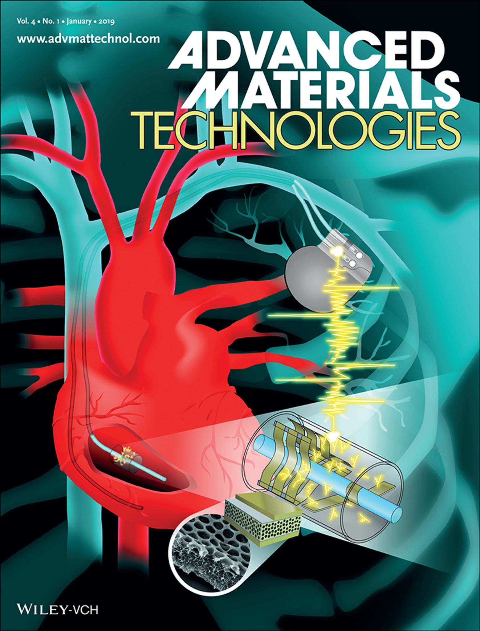 Powering Implantable Devices - NeuroLogica Blog