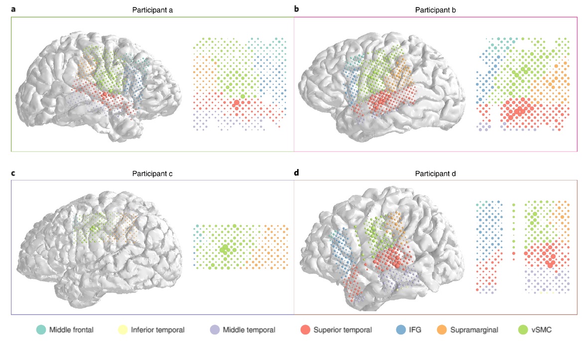 Decoding Speech from Brainwaves - NeuroLogica Blog