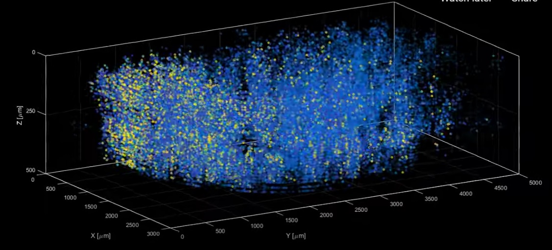 Light Beads Microscopy To Image Brain Activity - NeuroLogica Blog