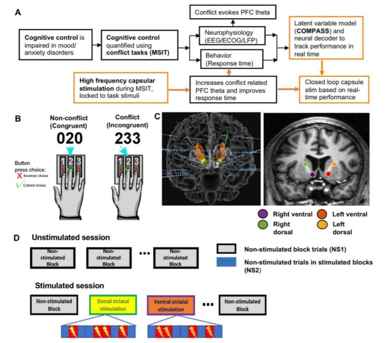 Brain Stimulation for Cognitive Control - NeuroLogica Blog