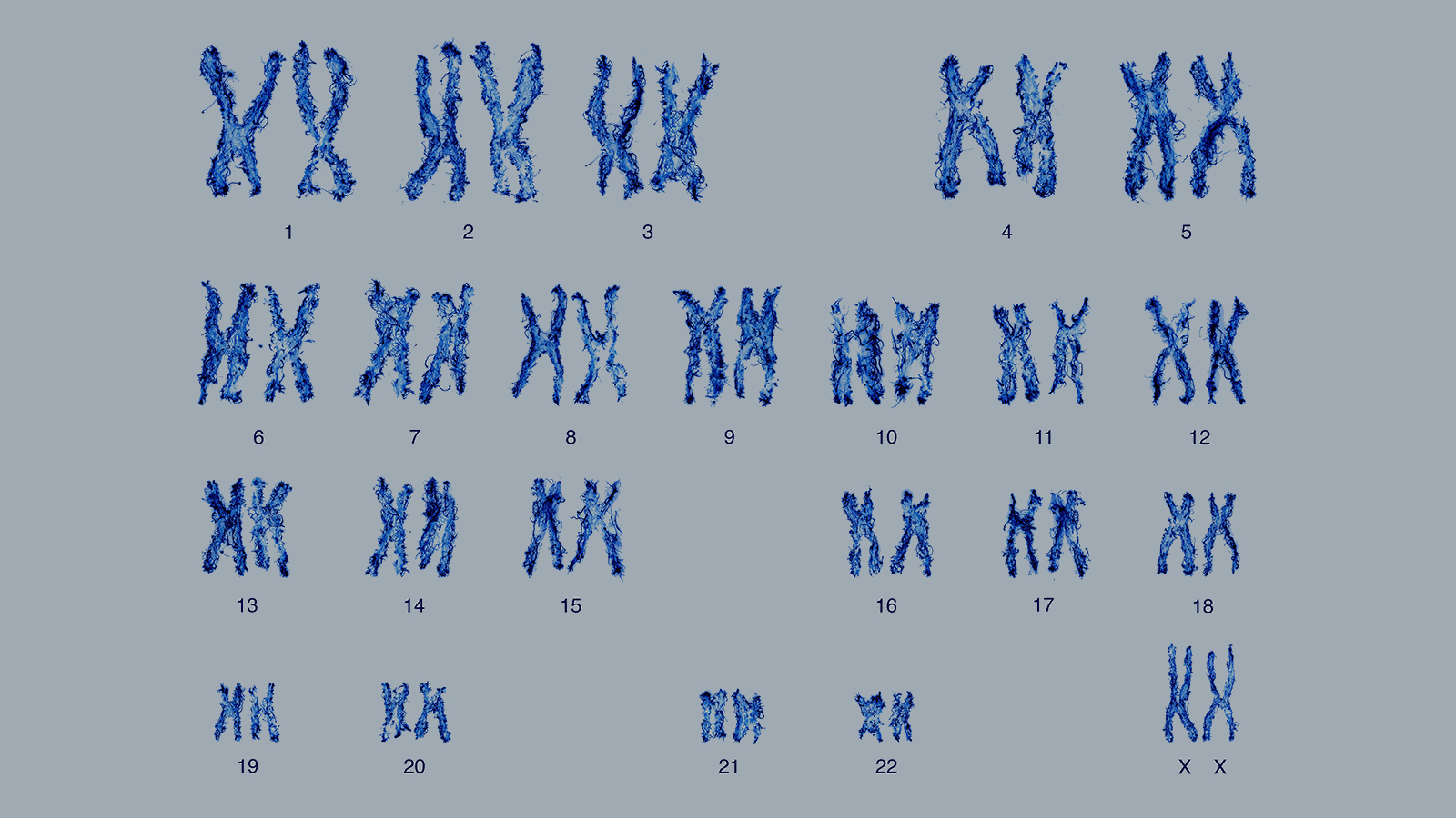 Chromosomal Elements Conserved for 600 Million Years - NeuroLogica Blog