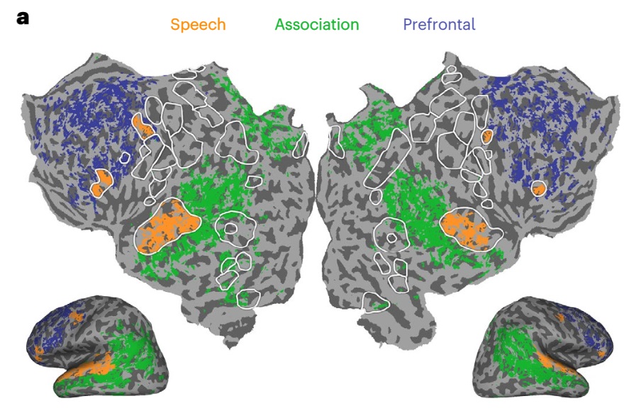 Reading The Mind with fMRI and AI - NeuroLogica Blog