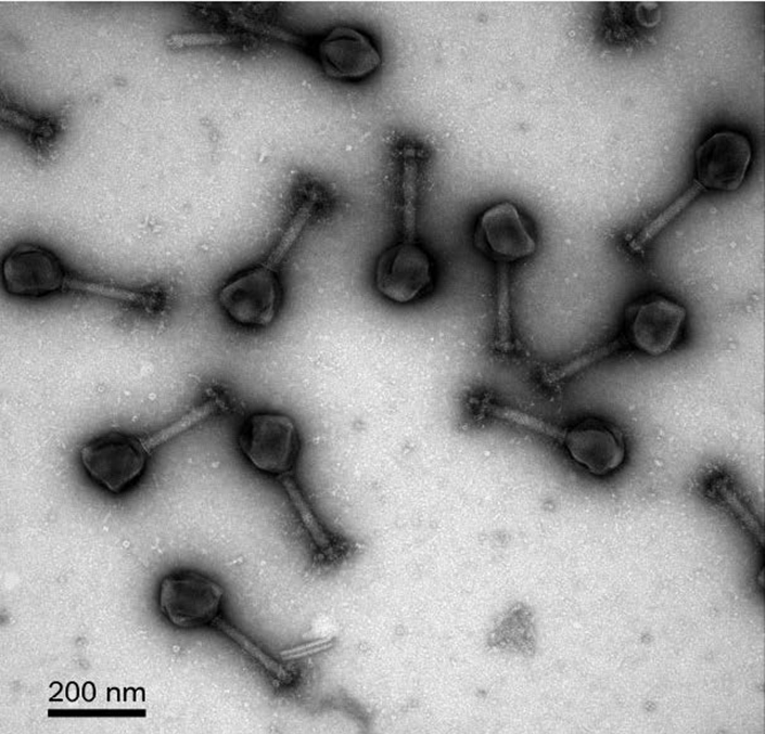 Understanding Jumbo Phage Viruses - NeuroLogica Blog